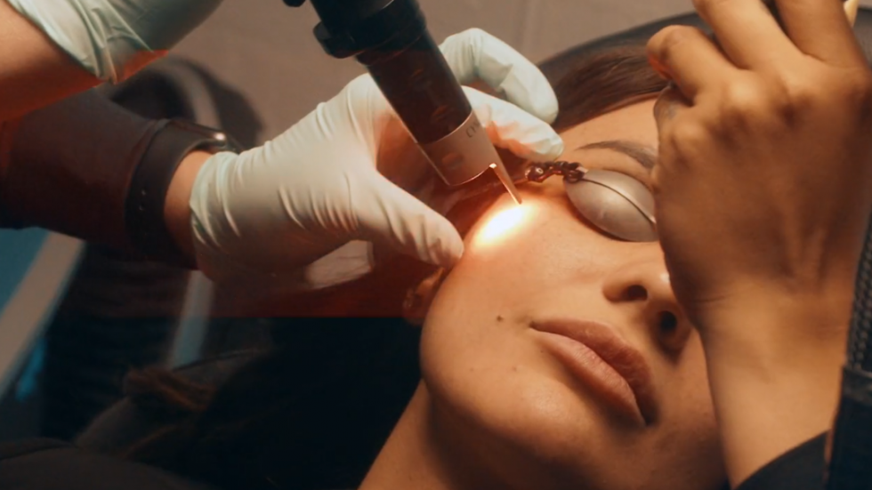 Traitements contre les tâches pigmentaires - Aphrodite Clinique Médico-Esthétique